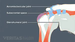 Subacromial Impengement Syndrome – OvitaminPro